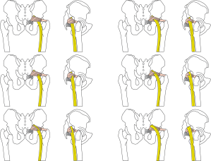 Piriformis revisited – The BMAS Blog