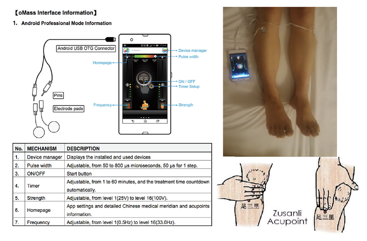 Smartphone-controlled TENS – The BMAS Blog